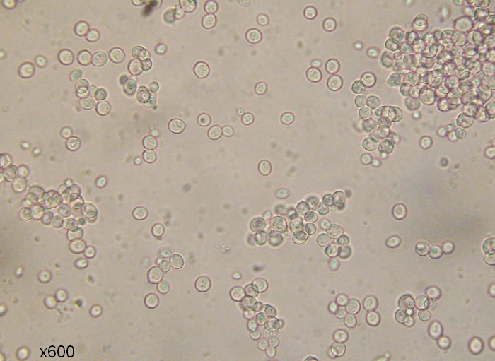 Cours : "Le risque infectieux et la protection de l'organisme ...